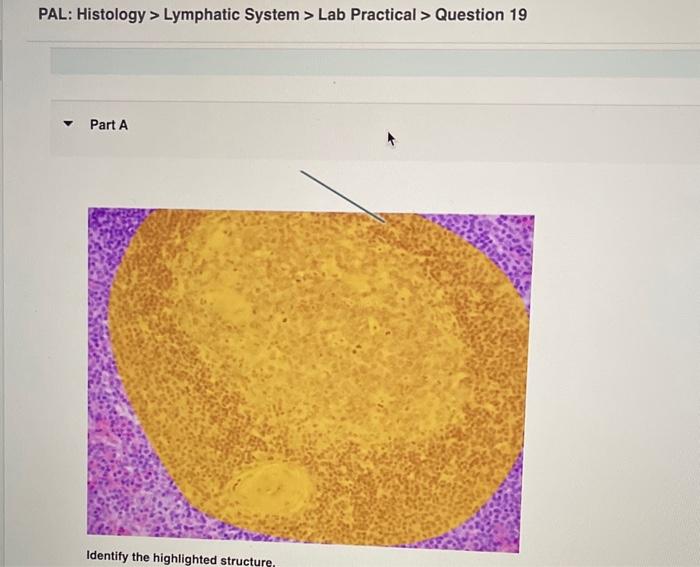 Solved PAL: Histology > Lymphatic System > Lab Practical > | Chegg.com