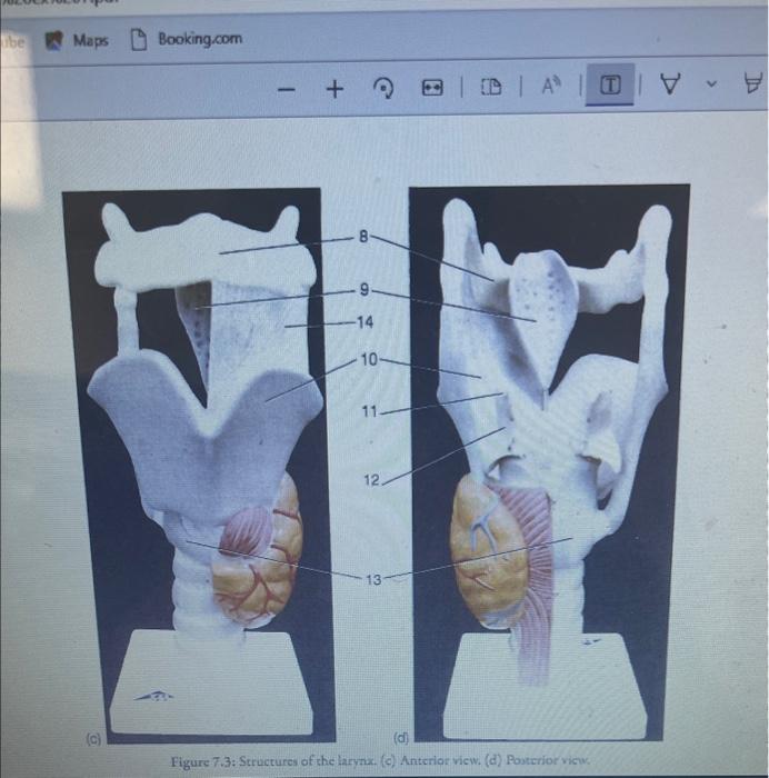 Exercisc 4: Anatomy of the Larynx Label the | Chegg.com