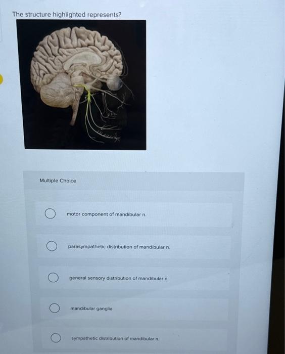 Solved Which structure is highlighted? Multiple Choice | Chegg.com