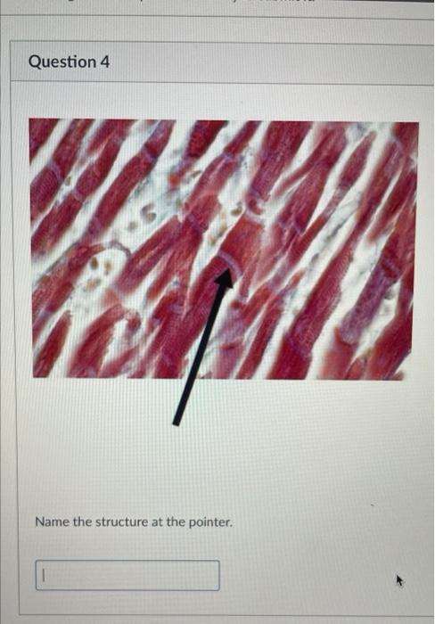 Solved Name the structure at the pointer. | Chegg.com