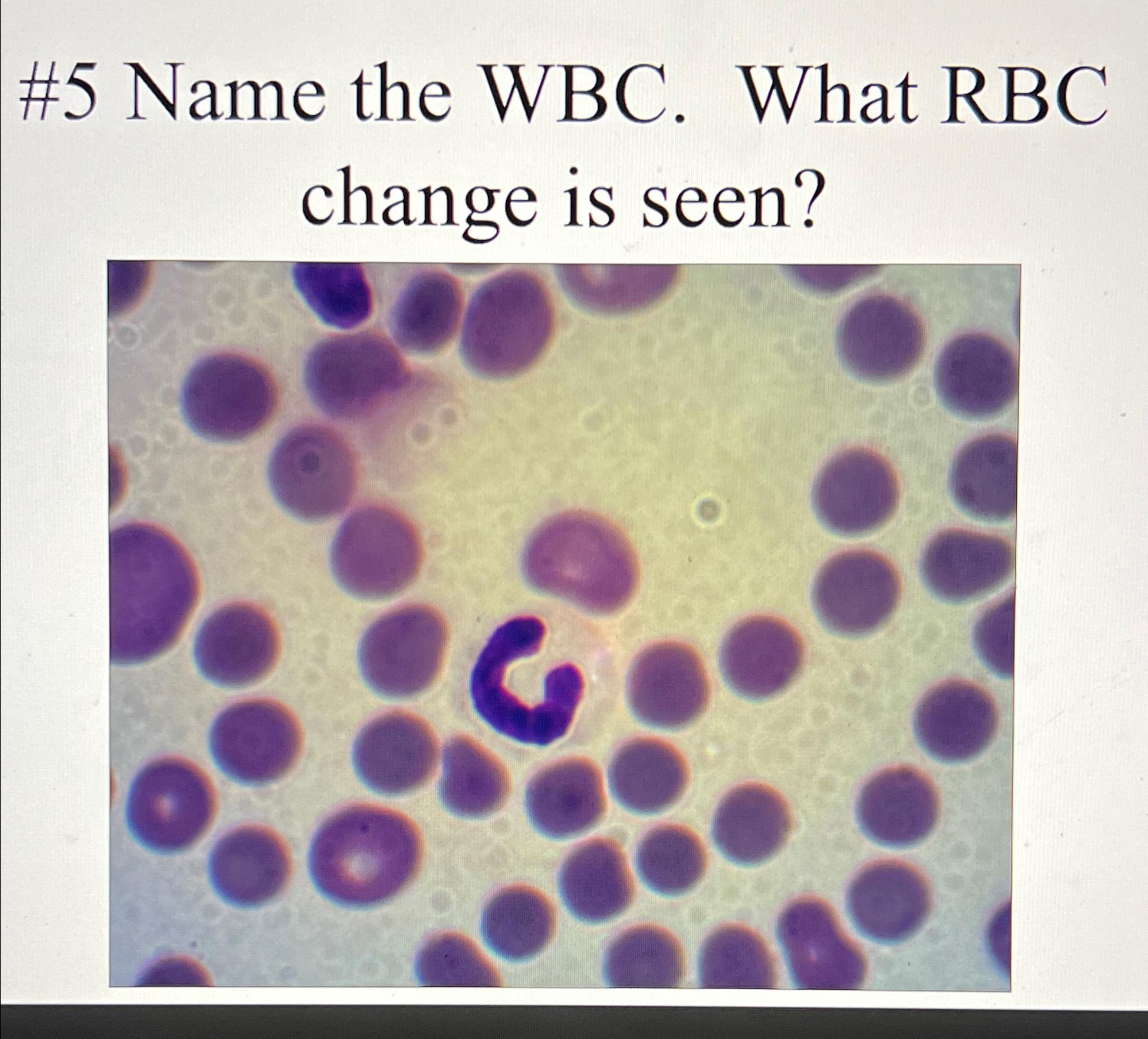 Solved #5 ﻿Name the WBC. ﻿What RBC change is seen? | Chegg.com