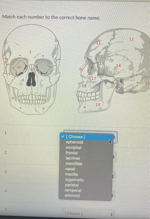 Solved Match each number to the correct bone name. 20 17 1 2 | Chegg.com