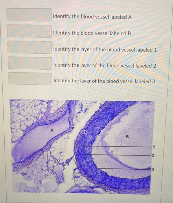 Solved Question 27: identify the blood vessel labeled | Chegg.com