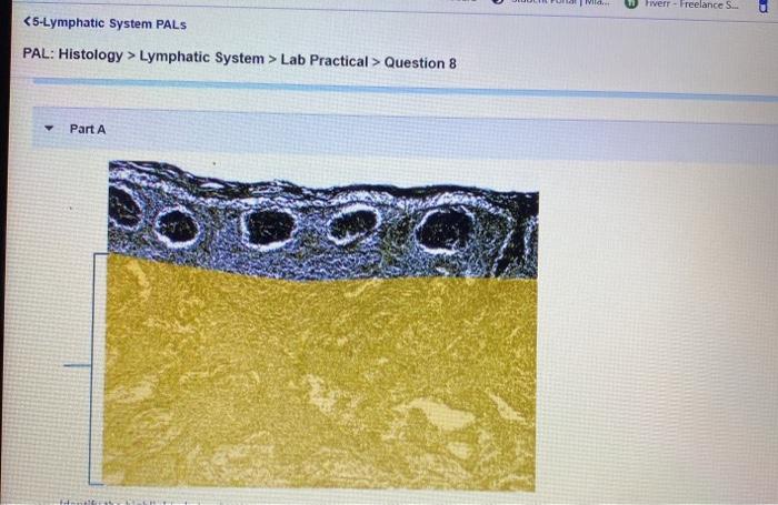 Solved Lymphatic | Chegg.com