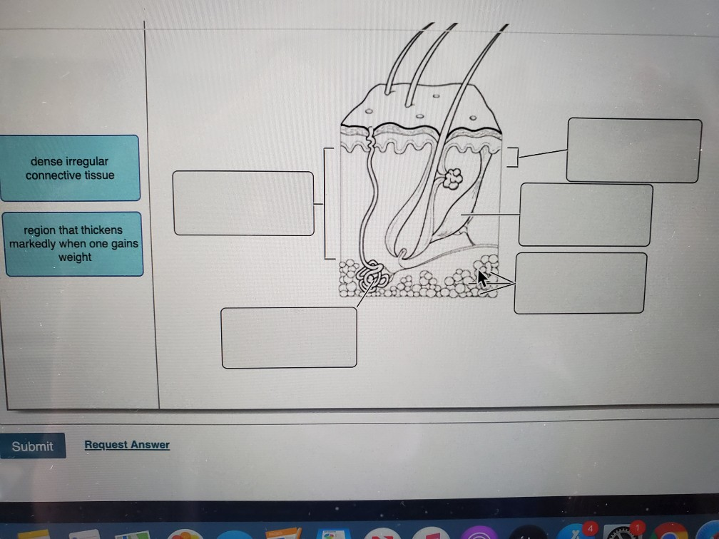 Solved dense irregular connective tissue region that | Chegg.com