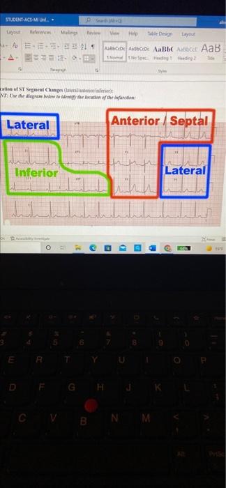 Solved STUDENT ACS-MU... Layout Beerenc Muling Review Vi | Chegg.com