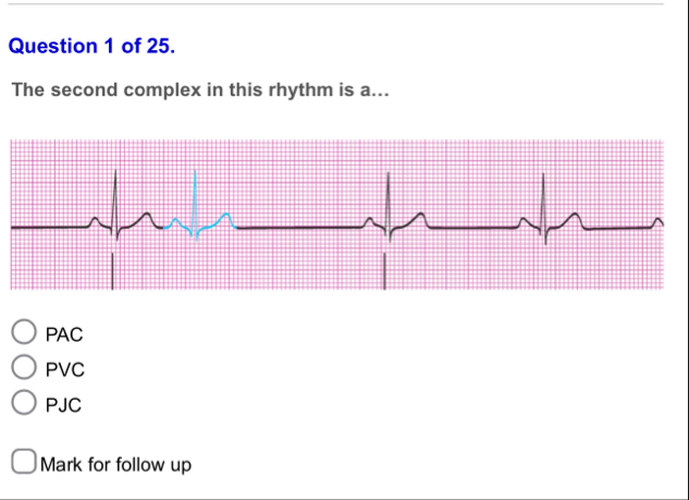 Solved Question 1 ﻿of 25.The second complex in this rhythm | Chegg.com