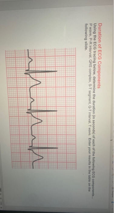 Solved Duration of ECG Components Using the ECG tracing | Chegg.com