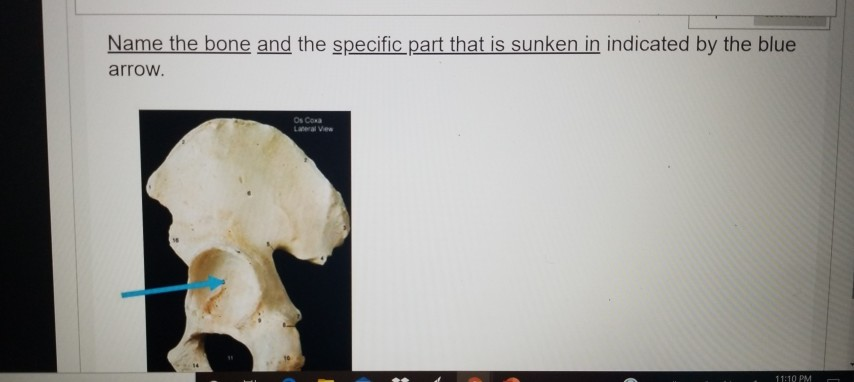 Solved Name the bone and the specific part that is sunken in | Chegg.com