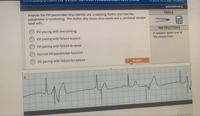 Solved Analyze this W1 pacemaker strip. Identify any | Chegg.com