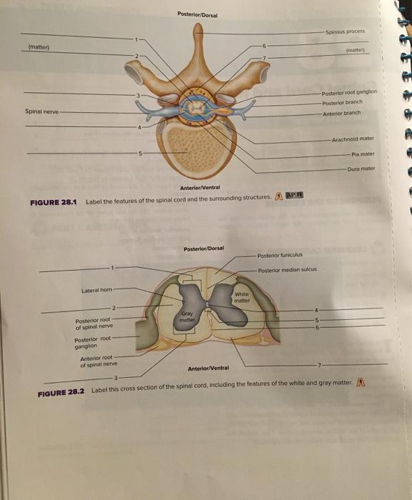 Solved Posterior Dorsal Spinous process matter) matte | Chegg.com