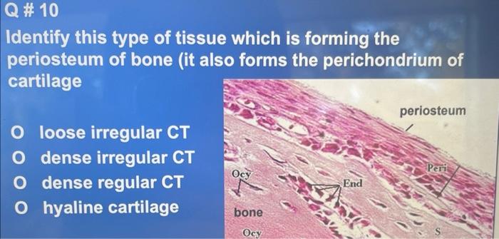 Solved Identify this type of tissue which is forming the | Chegg.com