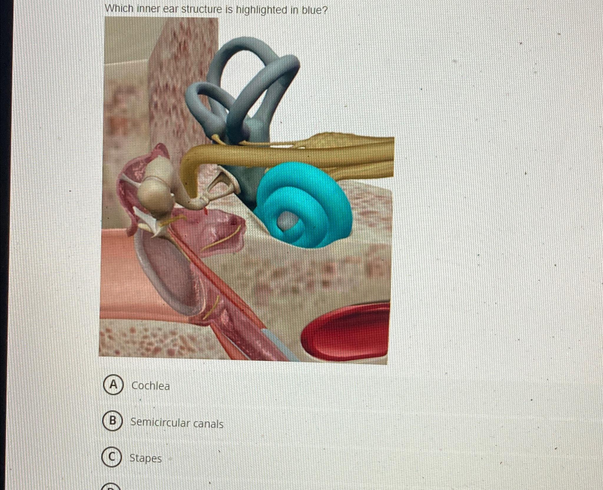 Solved Which inner ear structure is highlighted in | Chegg.com