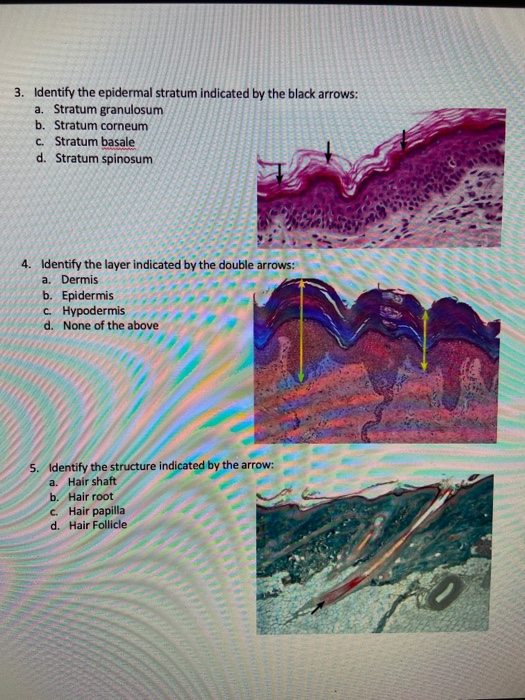 Solved Identify the structure indicated by the double arrow: | Chegg.com