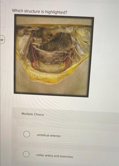 Solved Which structure is highlighted? 17 Multiple Choice | Chegg.com