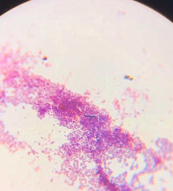 Solved Identify this unknown bacteria on this gram stain | Chegg.com