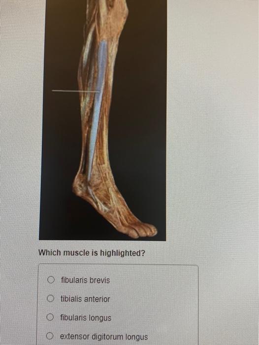 Solved Which muscle is highlighted? O fibularis brevis O | Chegg.com