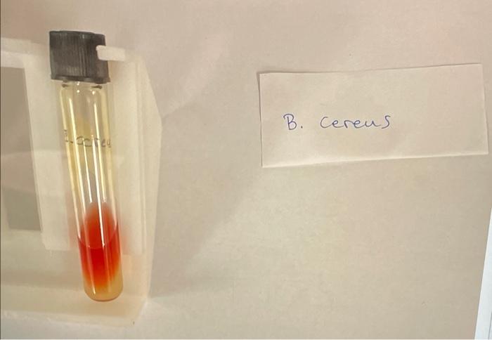 Solved PART B: Methyl Red Test and Voges-Proskauer Test | Chegg.com