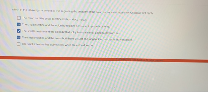 Solved Which of the following statements is true regarding | Chegg.com