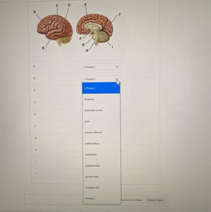 Solved Question 21 1 pts Match the brain structure pictured | Chegg.com