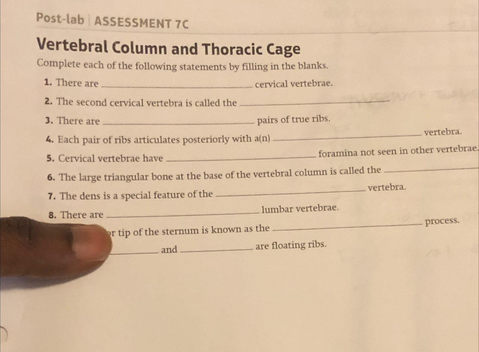 Solved Post-lab ASSESSMENT 7CVertebral Column and Thoracic | Chegg.com
