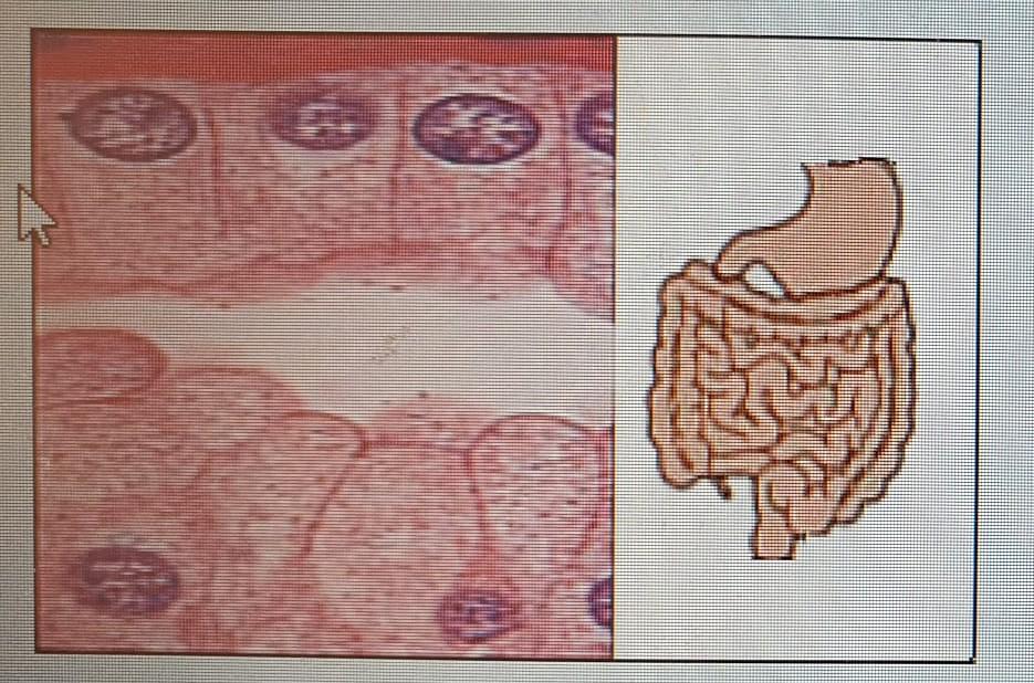 Solved Which of the following is the epithelial structure | Chegg.com
