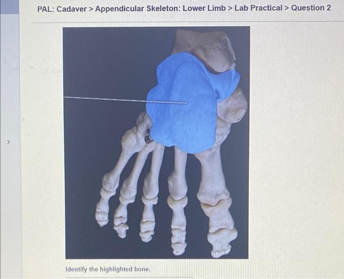 Solved PAL: Cadaver > Appendicular Skeleton: Pelvic Girdle > | Chegg.com