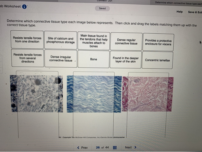Solved: Connect- 201 Determine Which Connective Tissue Typ... | Chegg.com