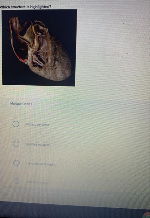 Solved Which structure is highlighted? Multiple Choice | Chegg.com