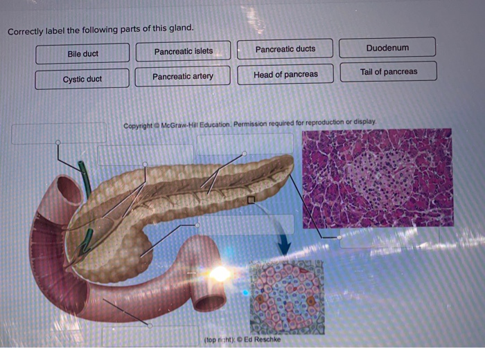 Solved: Correctly Label The Following Parts Of This Gland.... | Chegg.com