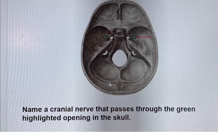 Name a cranial nerve that passes through the green | Chegg.com
