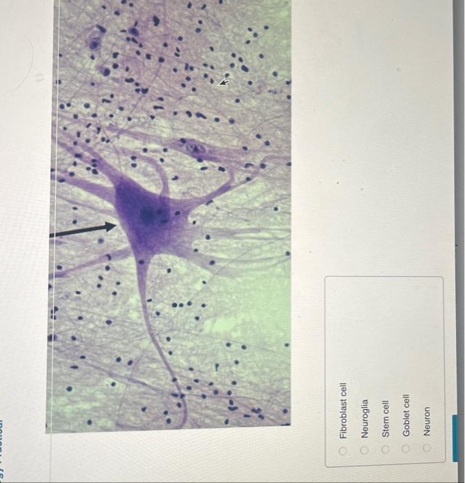 Solved Fibroblast cell Neuroglia Stem cell Goblet cell | Chegg.com