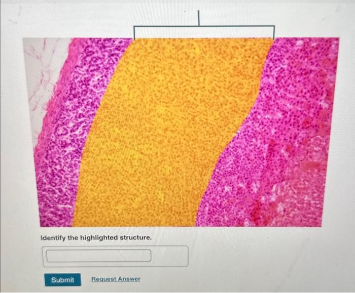 Solved Identify the highlighted structure. | Chegg.com