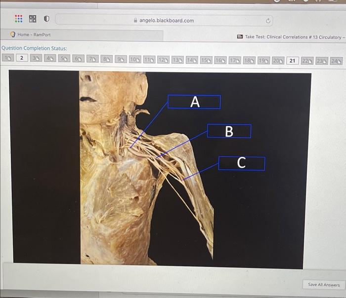 Solved label the arteries in the picture | Chegg.com