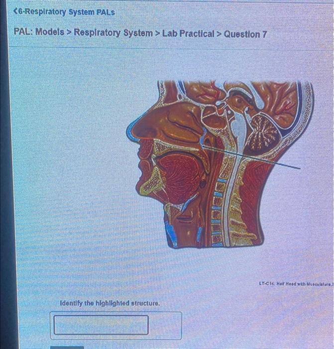 Solved Respiratory System > Lab Practical > Question 7 | Chegg.com