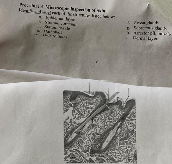 Solved Procedure - Microscopic Inspection of Skin Identify | Chegg.com