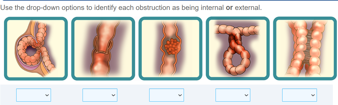 Solved Use the drop-down options to identify each | Chegg.com