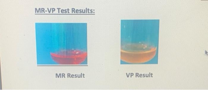 Solved SIM Deep Test: 7. Sulfur Indole Motility (SIM) | Chegg.com