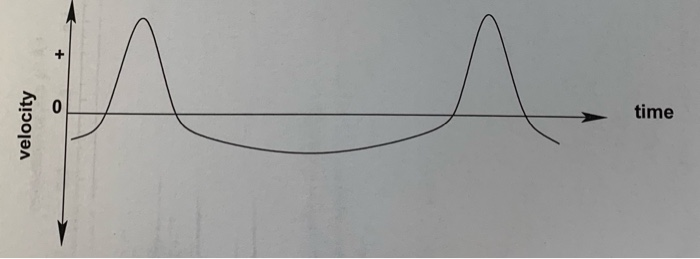 Solved The following figure shows the radial velocity curve | Chegg.com