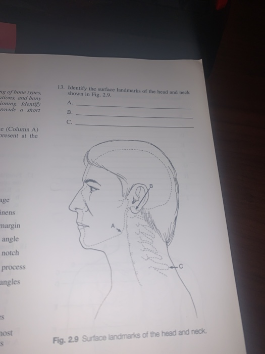 Solved 13. Identify the surface landmarks of the head and | Chegg.com