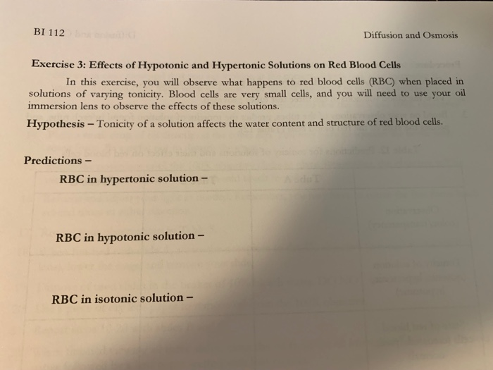Solved Exercise 1: Permeability of Dialysis Tubing Dialysis | Chegg.com
