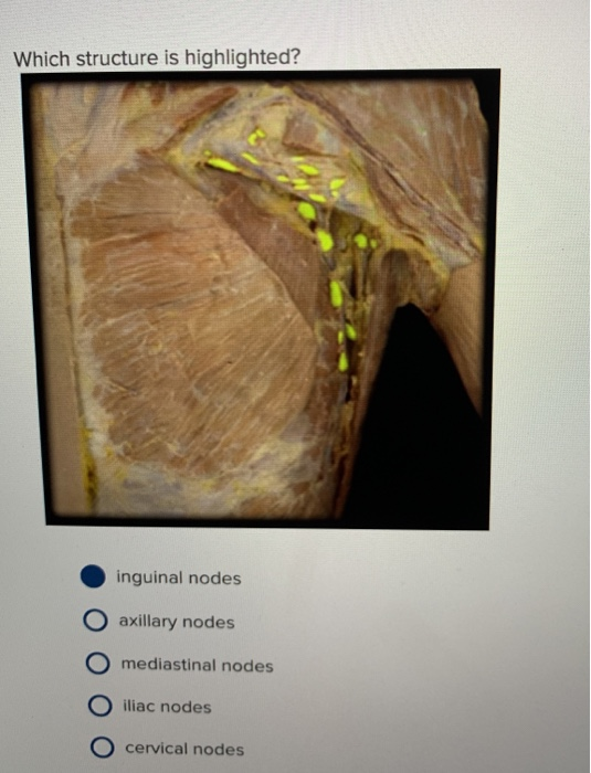 Solved Which structure is highlighted? inguinal nodes O | Chegg.com