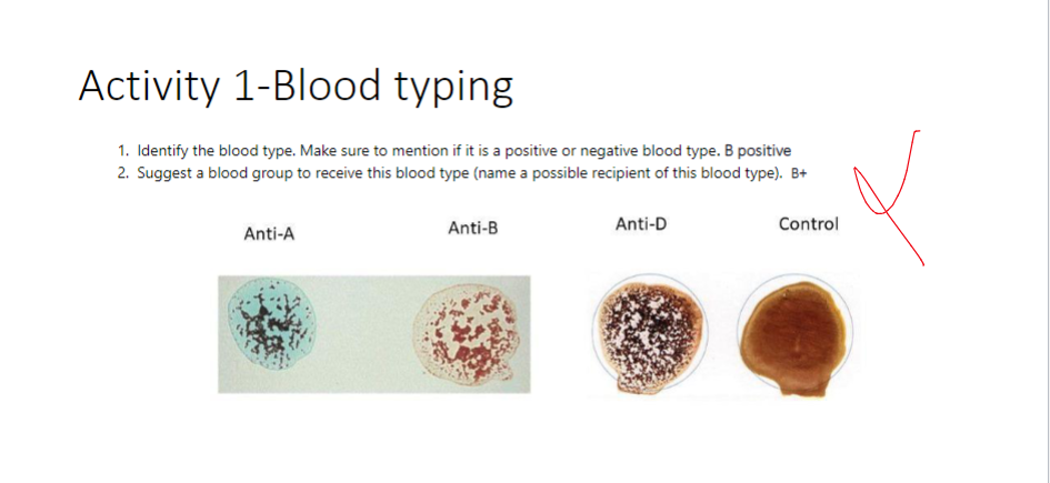 Activity 1-Blood typingIdentify the blood type. Make | Chegg.com
