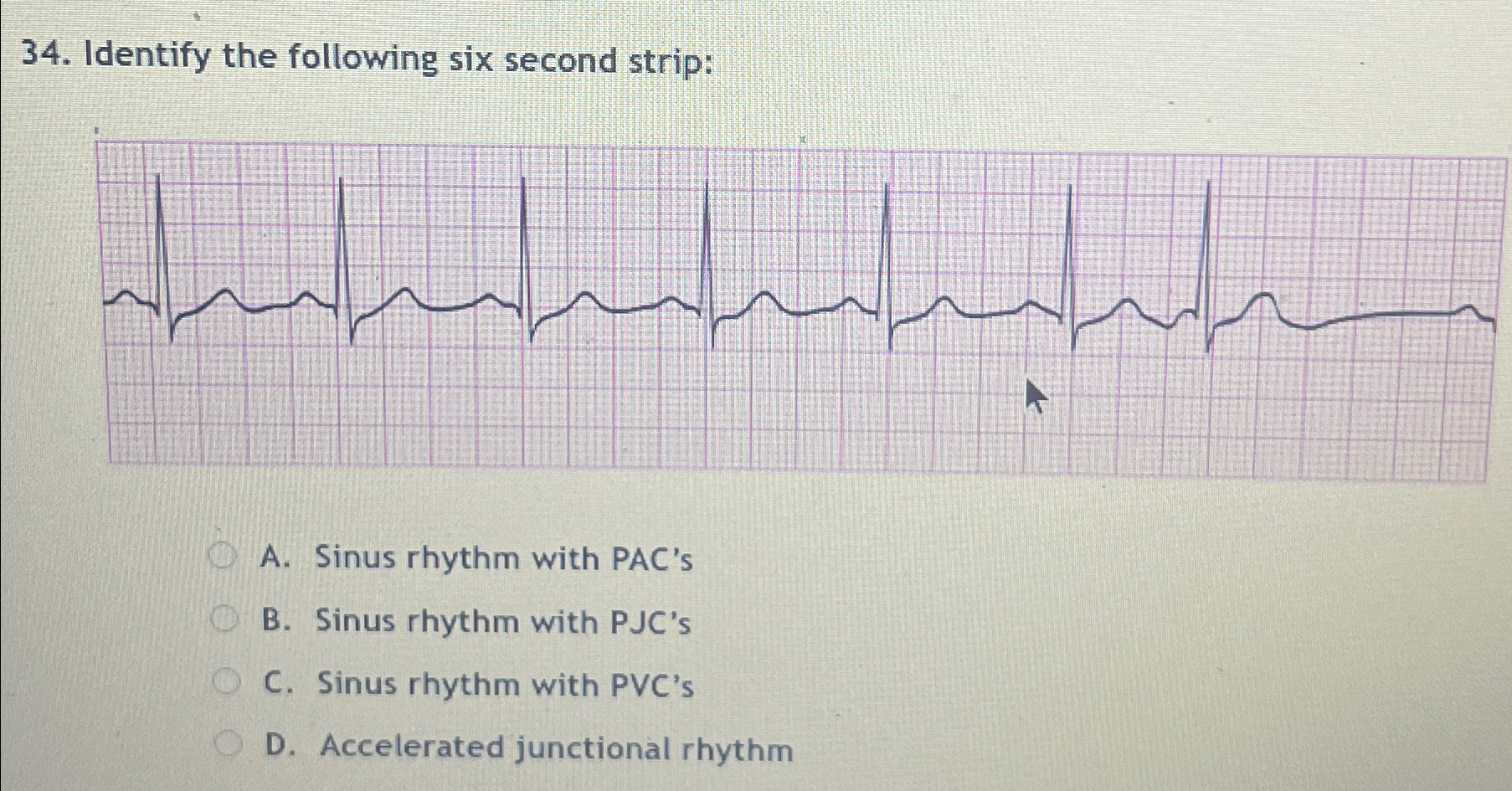 Solved Identify the following six second strip:A. ﻿Sinus | Chegg.com