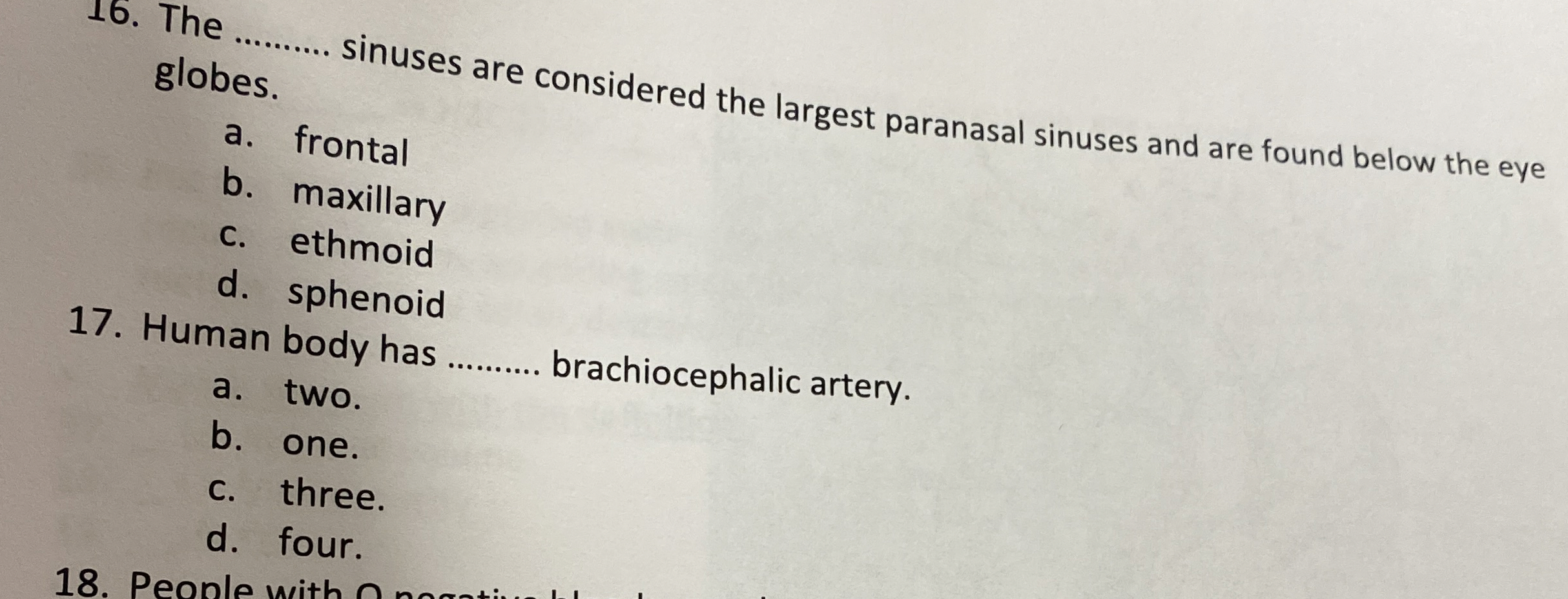 Solved The q, ﻿globes. sinuses are considered the largest | Chegg.com