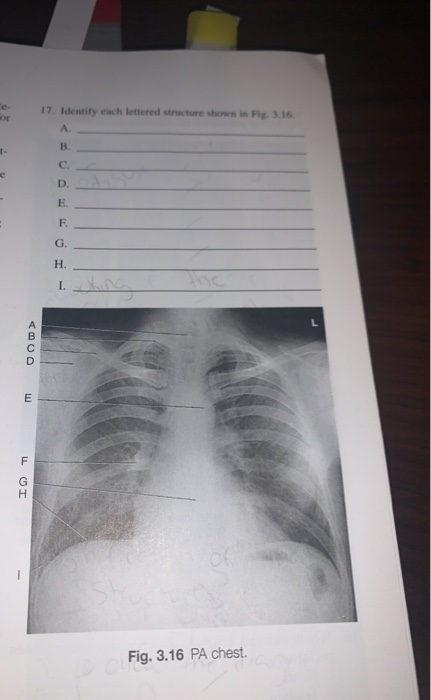 Solved E H 8. Identify each lettered structure shown in Fig. | Chegg.com