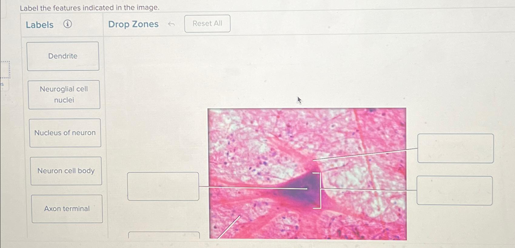 Solved Label the features indicated in the | Chegg.com