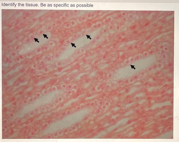 Solved Identify the tissue. Be as specific as possible | Chegg.com