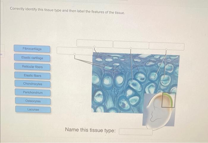 Solved Correctly identify this tissue type and then label | Chegg.com Solved Correctly identify this tissue type and then label | Chegg.com
