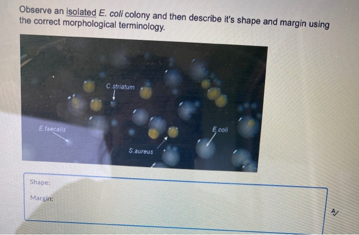 Solved Observe an isolated E. coli colony and then describe | Chegg.com